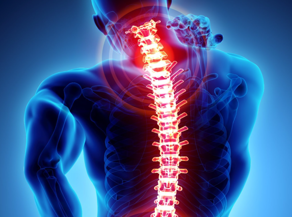 Spinal Cord Stimulator (SCS) - Pacific Pain and Spine